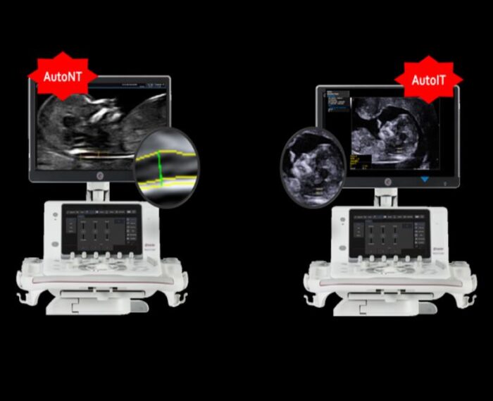 Máy Siêu Âm MyLab™ X8 - Nhập Khẩu Ý - Giá Ưu Đãi
